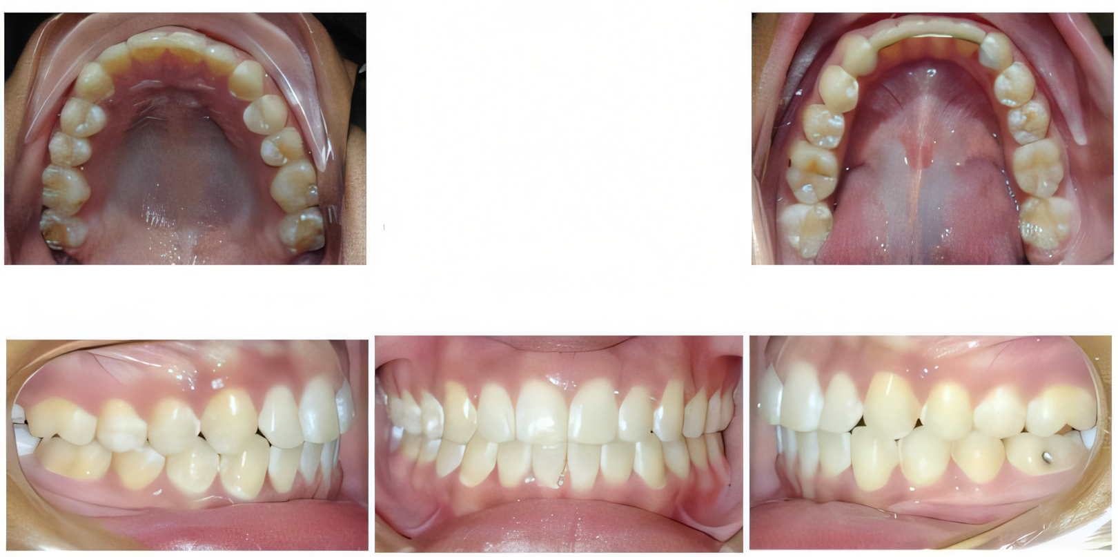 Buffalo Grove Orthodontics